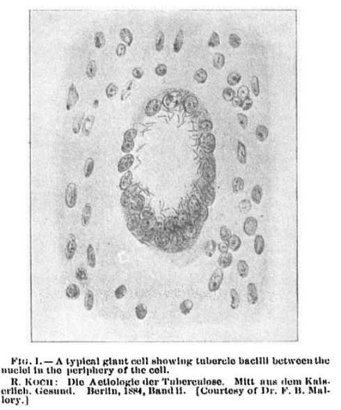 Massachusetts Medical Society: Surgical Tuberculosis