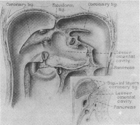 Massachusetts Medical Society: The Subphrenic Spaces and the Emperor's ...